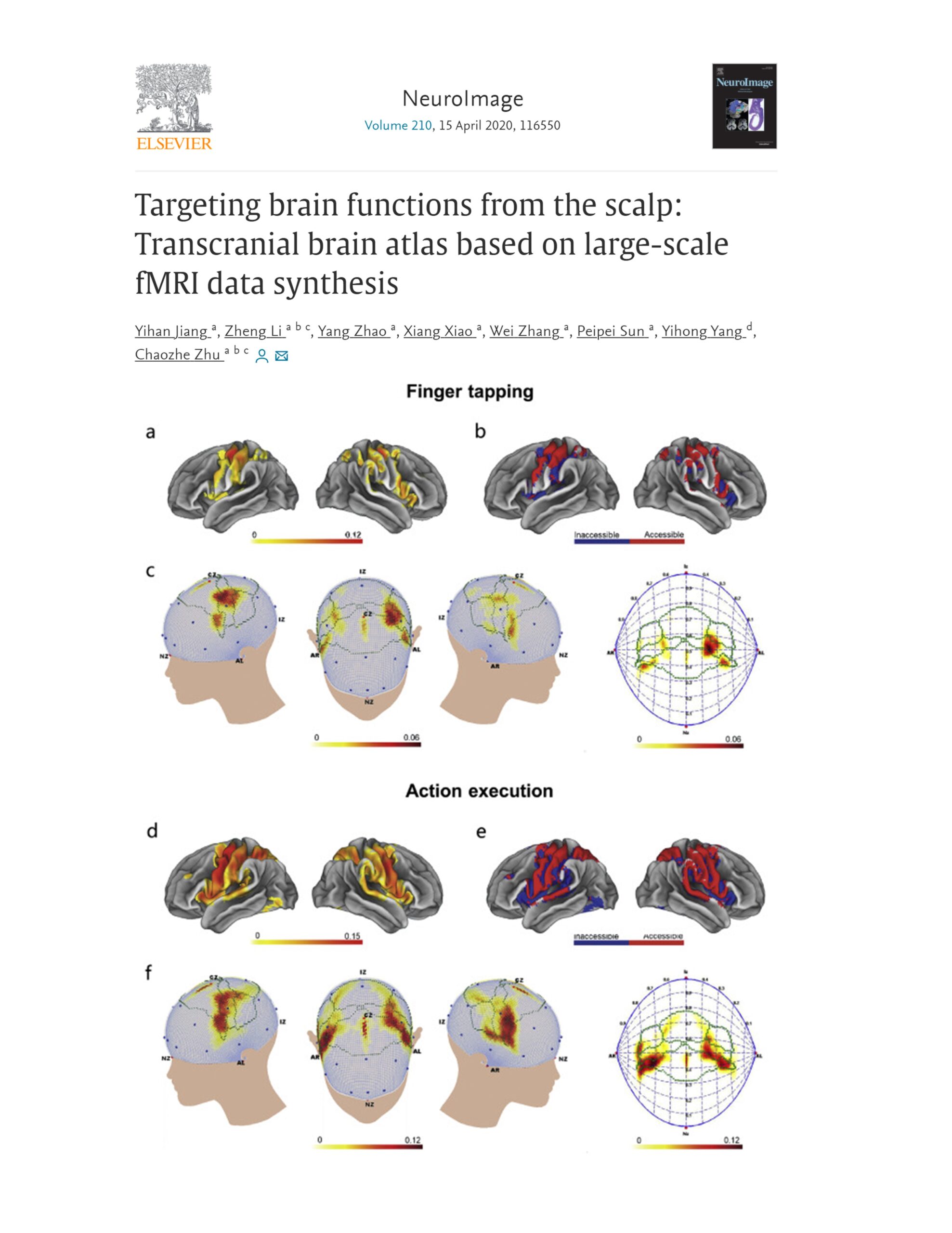 Transcranial Brain Atlas