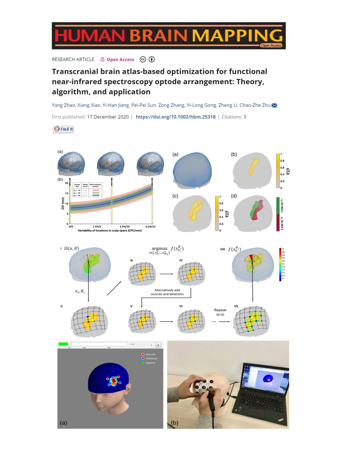 Transcranial Brain Atlas